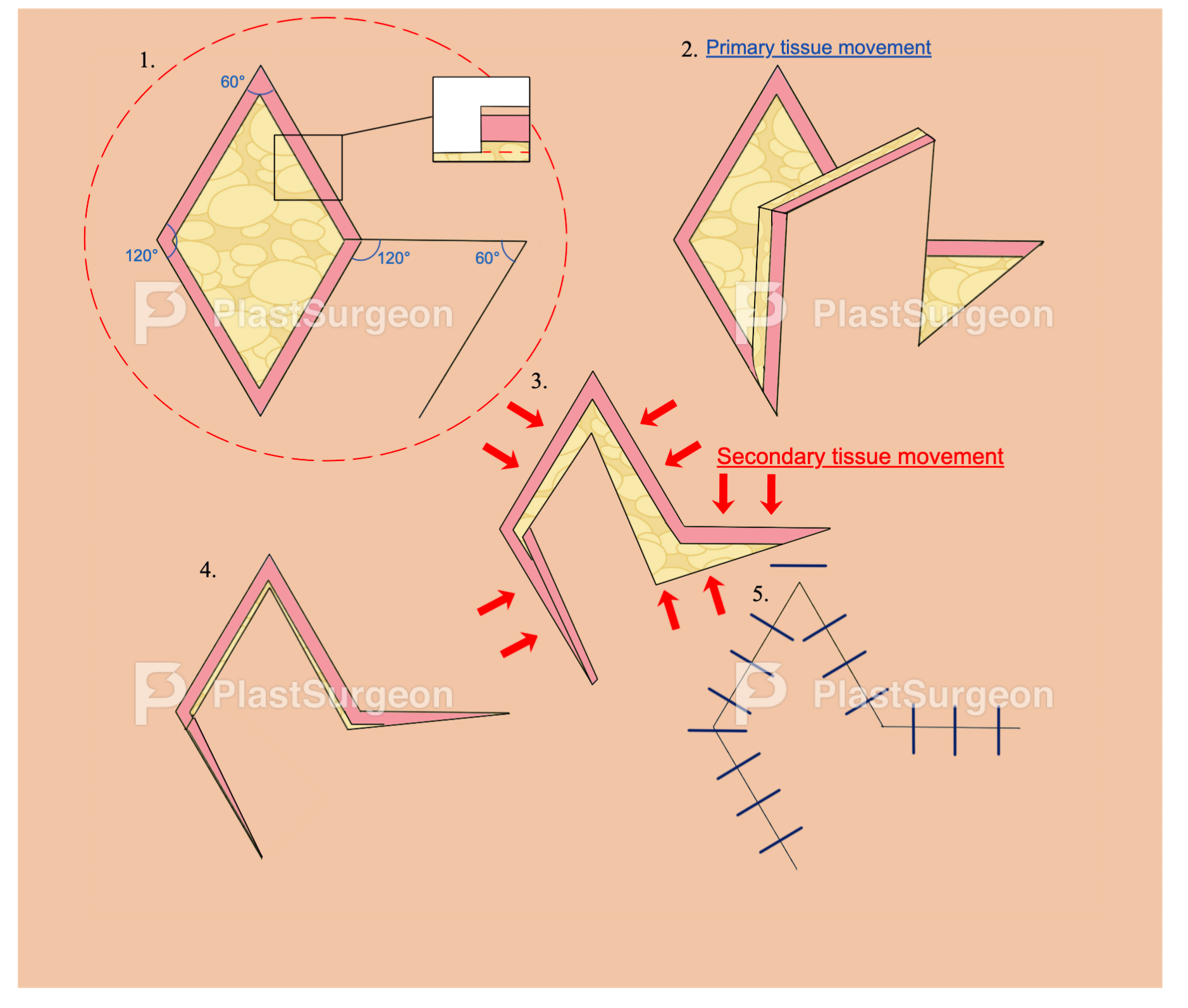Introduction – PlastSurgeon